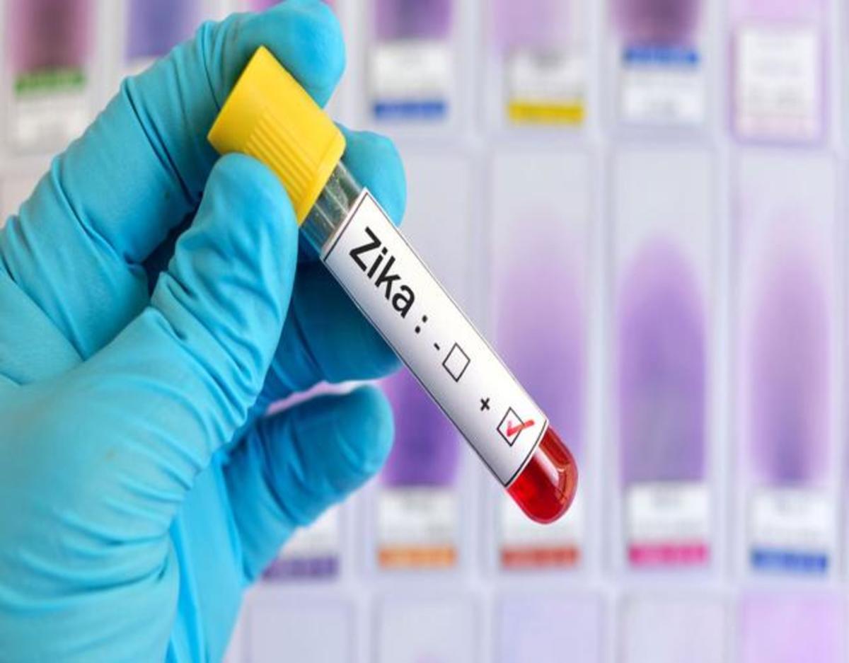 Zika en bebés